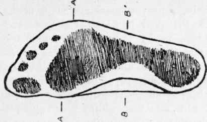 Measuring The Foot: Drafts, Impressions, Apparatus, And Measurements ...