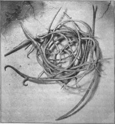 2. Ascaris Lumbricoides