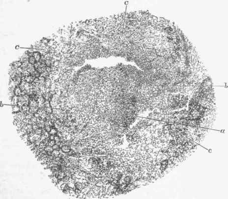 Anatomical Changes In Phthisis. Part 2