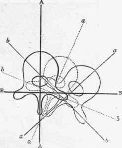 2. Lateral Curvature, Rotatory Curvature, Scoliosis