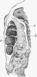 Anatomical Changes In Phthisis. Part 4