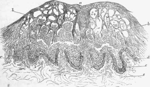 2. Symptomatic Inflammations