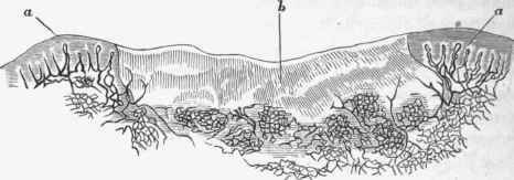 2. Symptomatic Inflammations
