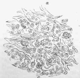 Syphilis. Continued