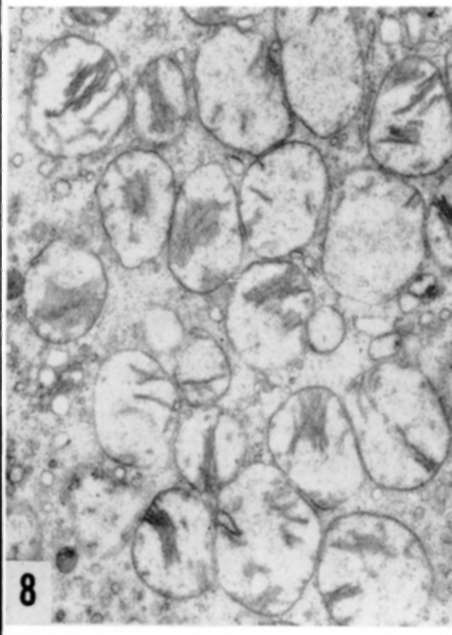 Different Aspects Of Nucleoli In Cancer Cells