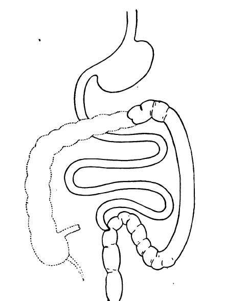 The Physiology Of The Colon, The Wrong Use To Which We Put The Colon ...