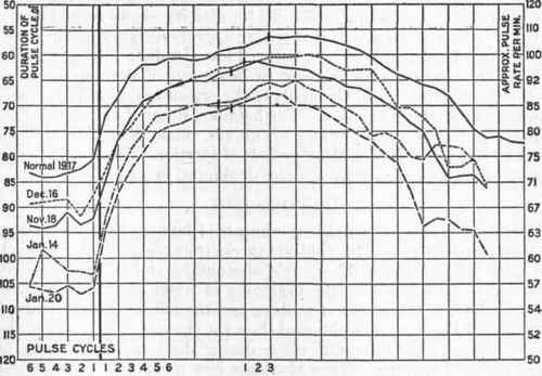 Changes In Pulse-Rate Occasioned By Short Periods Of Exertion. Part 3