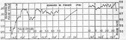 Transition Pulse