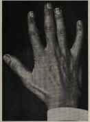 Chapter XII. The Finger Tips